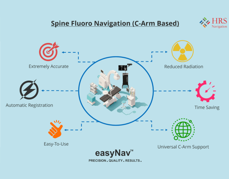Optical Navigation with easyNav for Precision Surgery